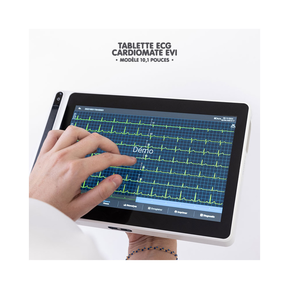 ECG numérique Cardiomate PC SPENGLER - LD Médical