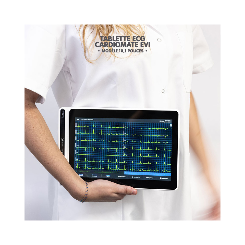 ECG numérique Cardiomate PC SPENGLER - LD Médical