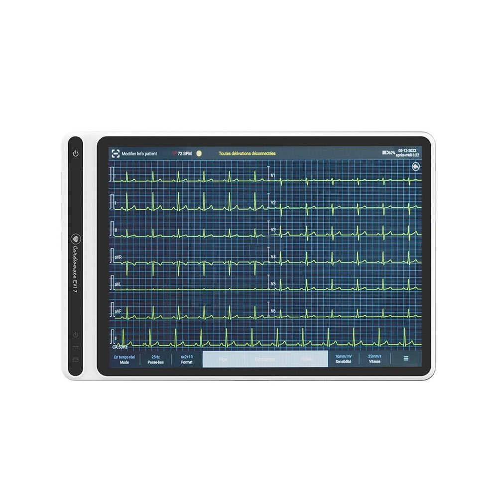 ECG numérique Cardiomate PC SPENGLER - LD Médical